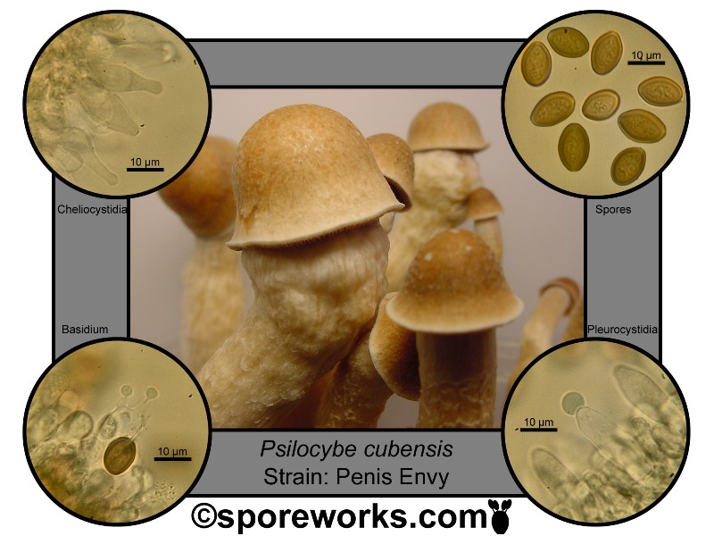 A little microscopy : r/mycology